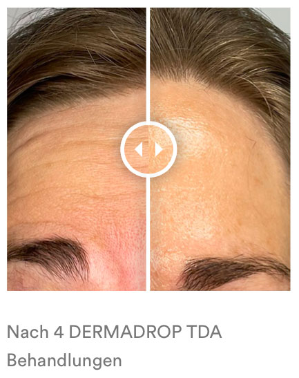 TDA BioBTX - Topkapi Topskin